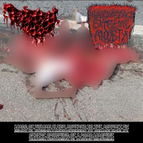 Neurocysticercosis By Taenia Solium Parasite - Song Download from Mass ...